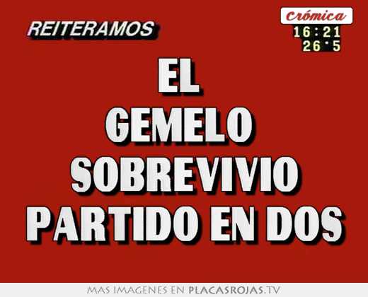 El gemelo sobrevivio partido en dos - Placas Rojas TV